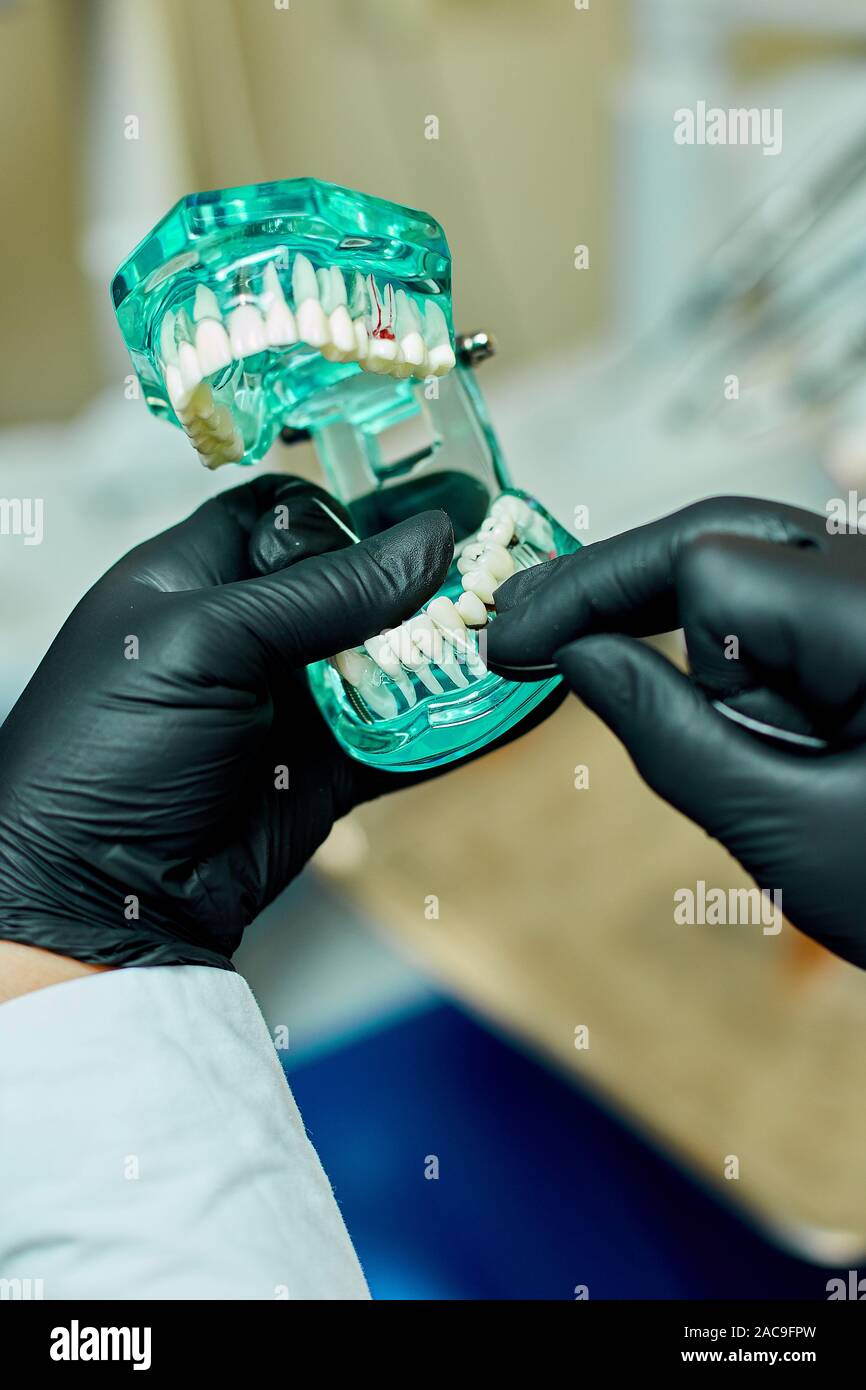 Dentist holding teeth model denture, showing with diagnostic ...