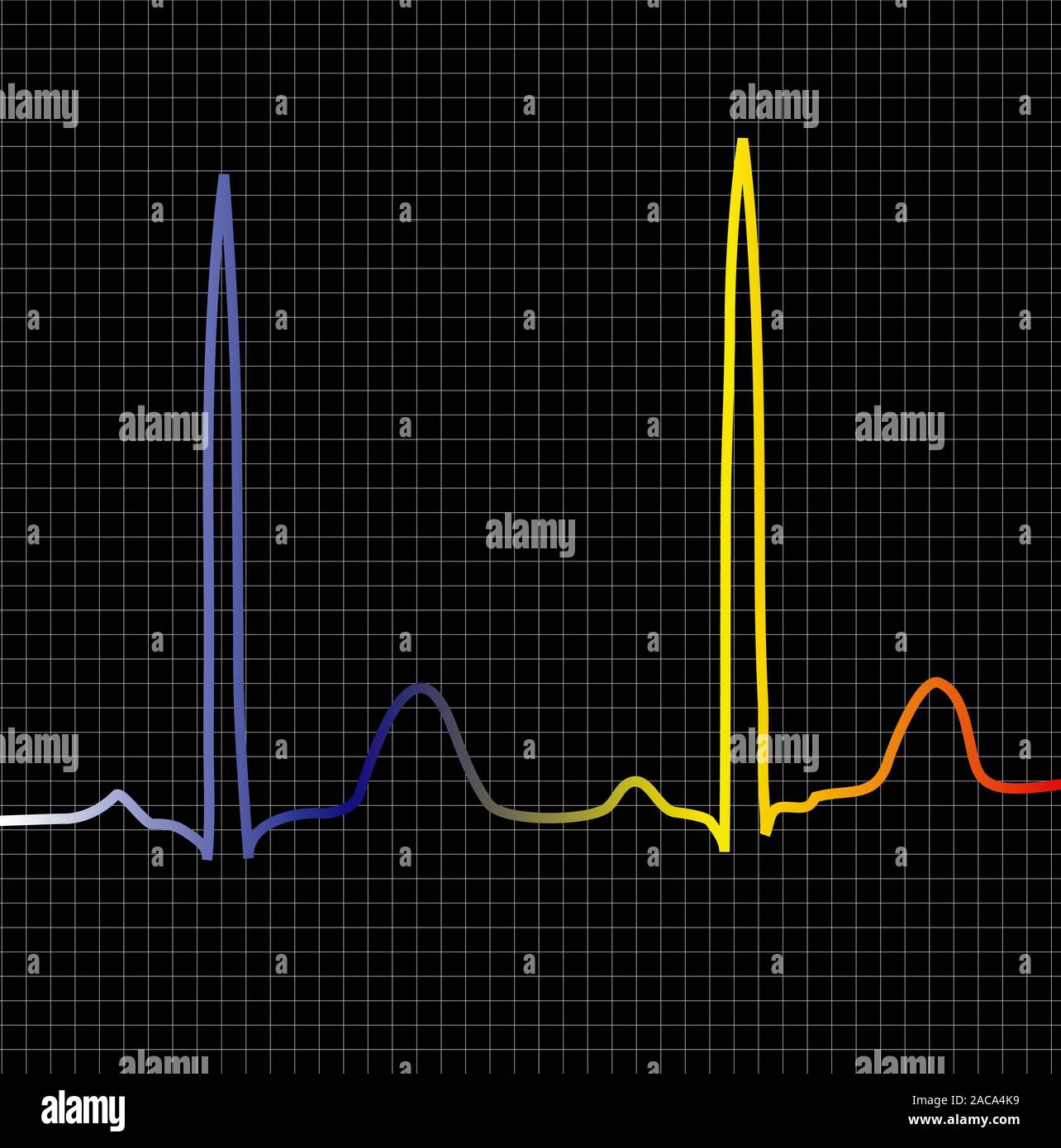 Ecg Chart High Resolution Stock Photography and Images - Alamy