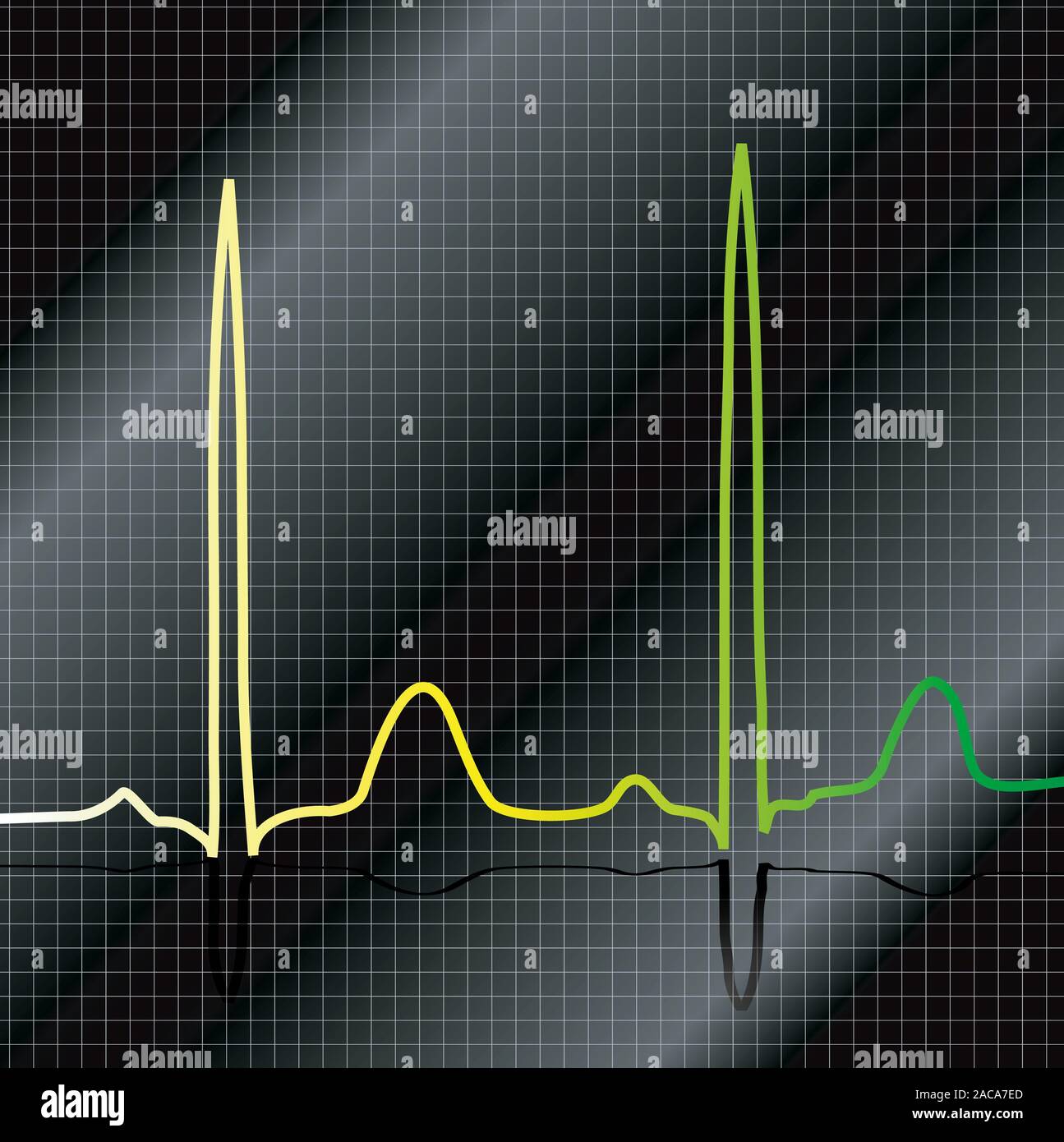 Cardiogram char hi-res stock photography and images - Alamy