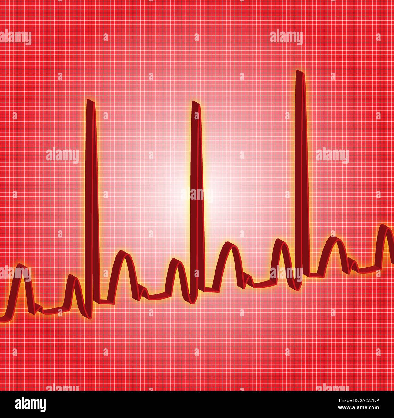 Exercise heartbeat hi-res stock photography and images - Alamy