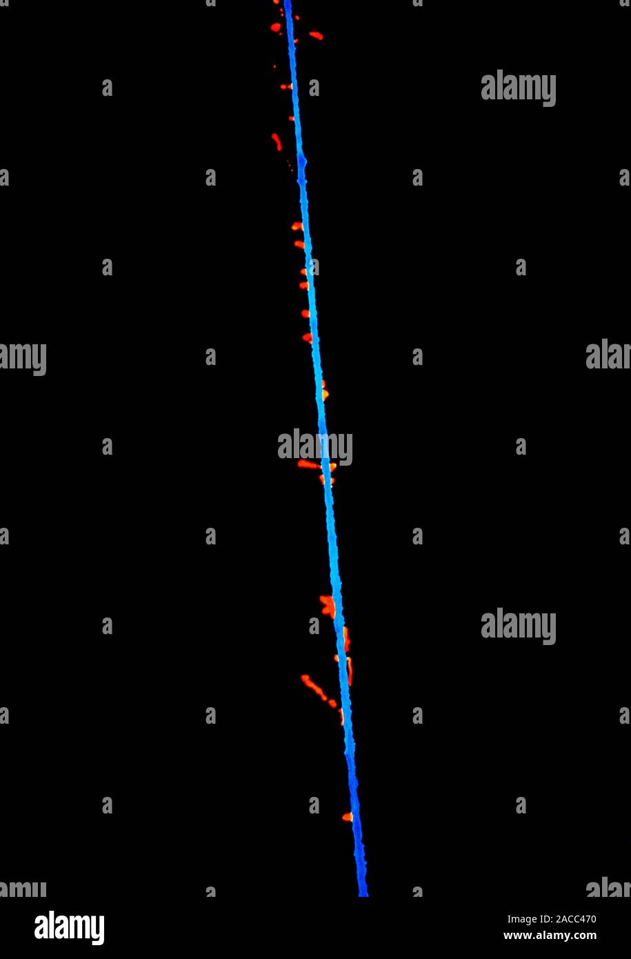 False-colour photograph of an alpha particle (blue track) in a hydrogen ...