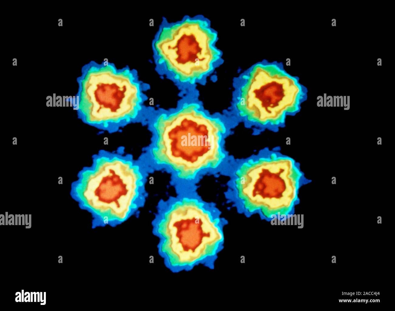 False-colour scanning transmission electron micrograph (STEM) of a ...
