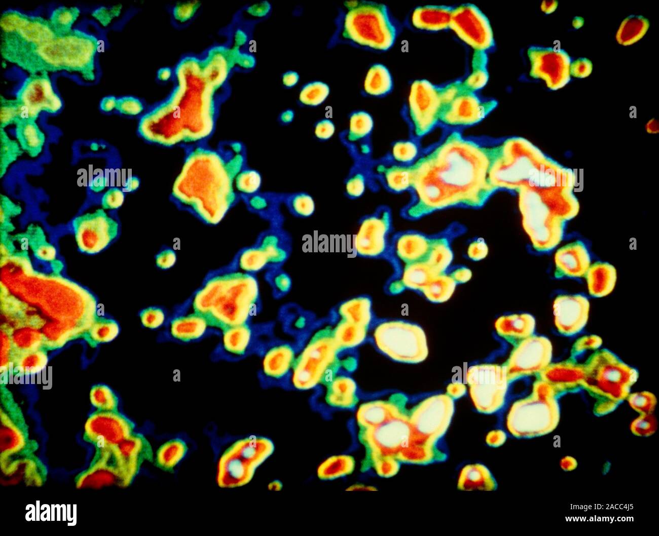 False-colour scanning transmission electron micrograph (STEM) of ...