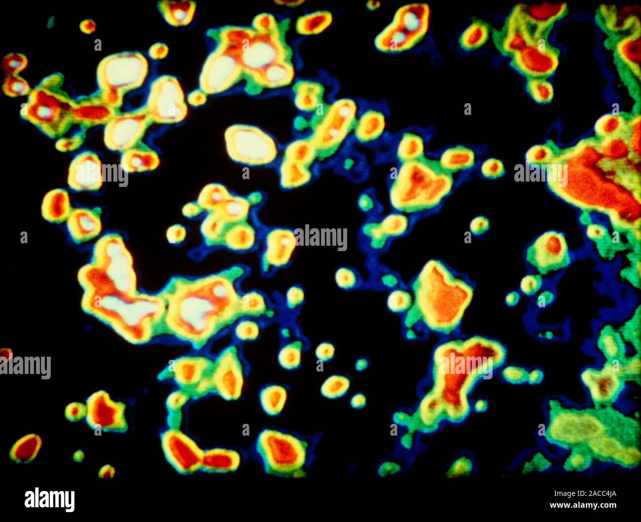 False-colour scanning transmission electron micrograph (STEM) of ...