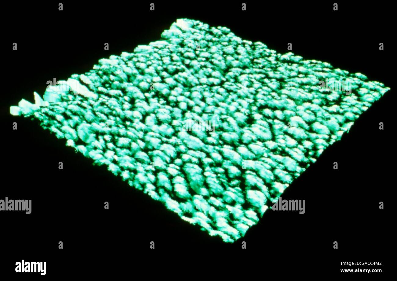 Scanning tunnelling micrograph of a deposit of boron on a silicon ...