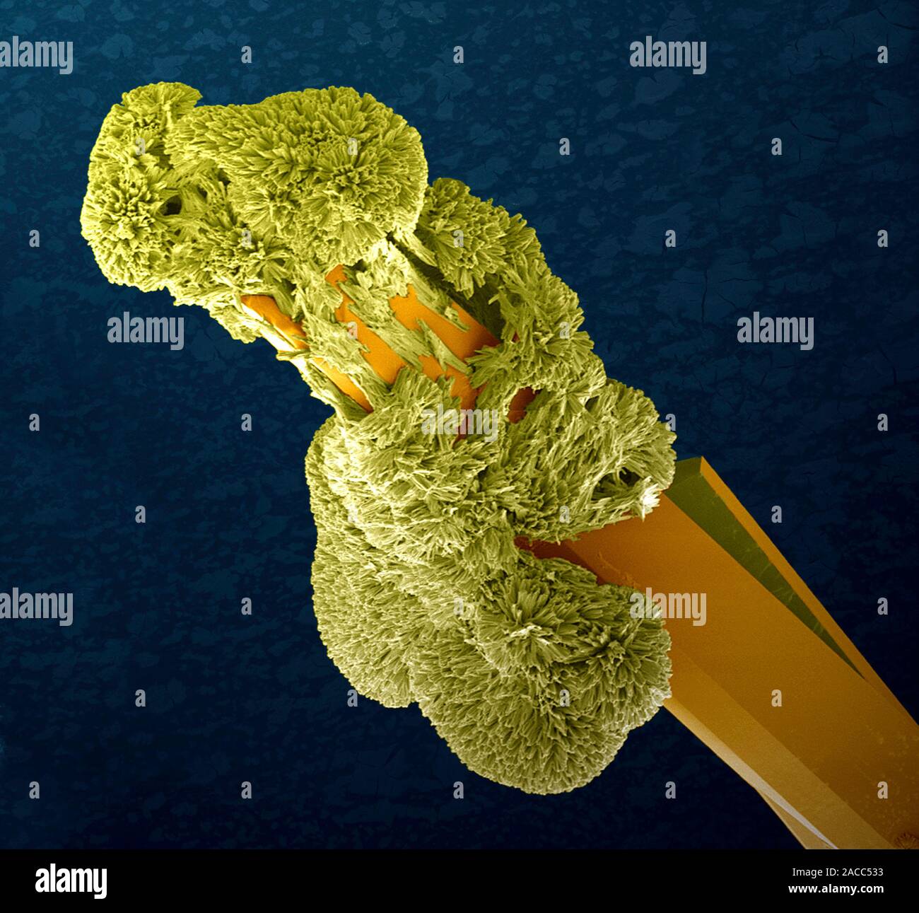 Uranyl acetate. Coloured scanning electron micrograph (SEM) of rhombic ...