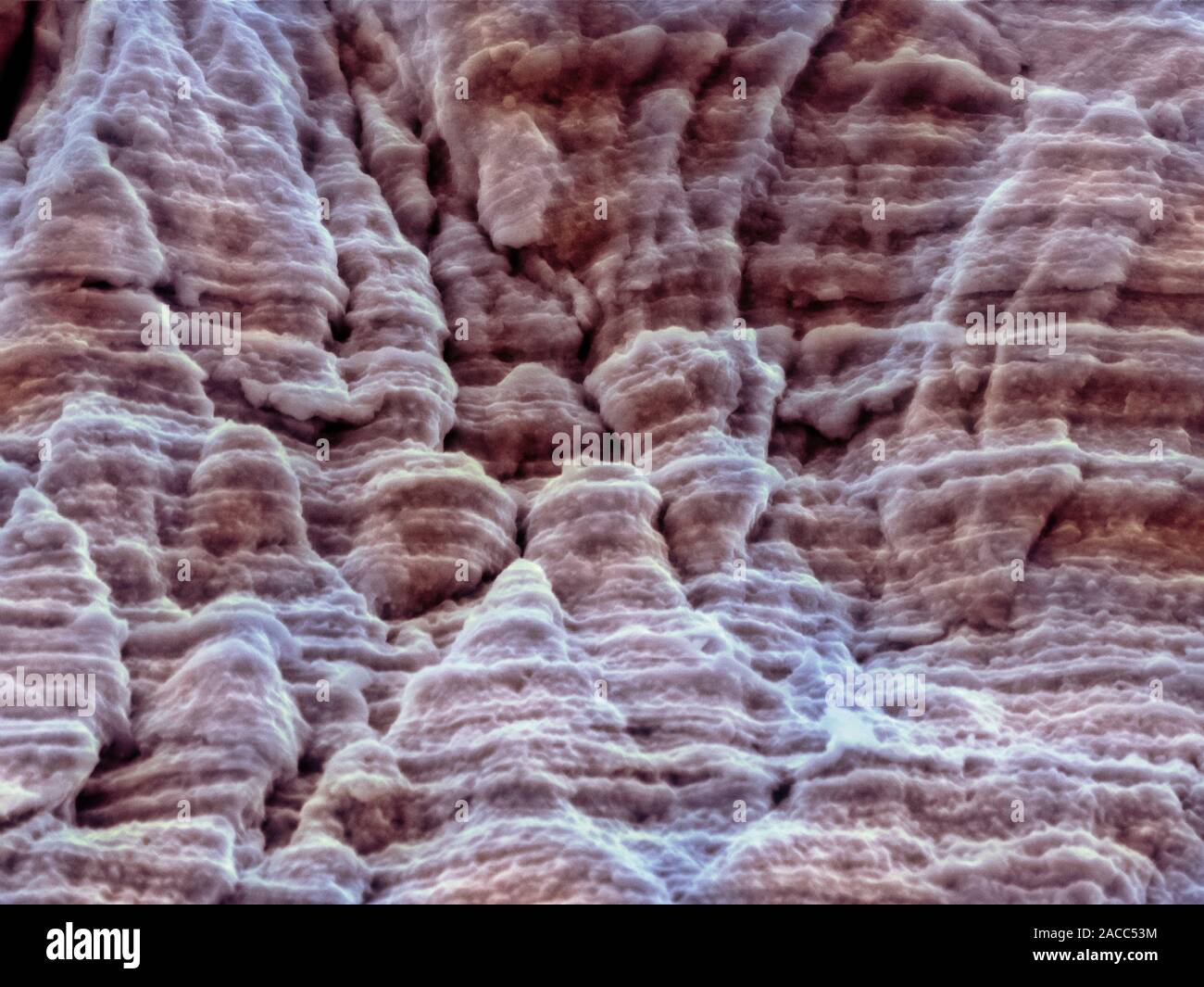 Bismuth, scanning electron micrograph (SEM). Bismuth is a heavy ...
