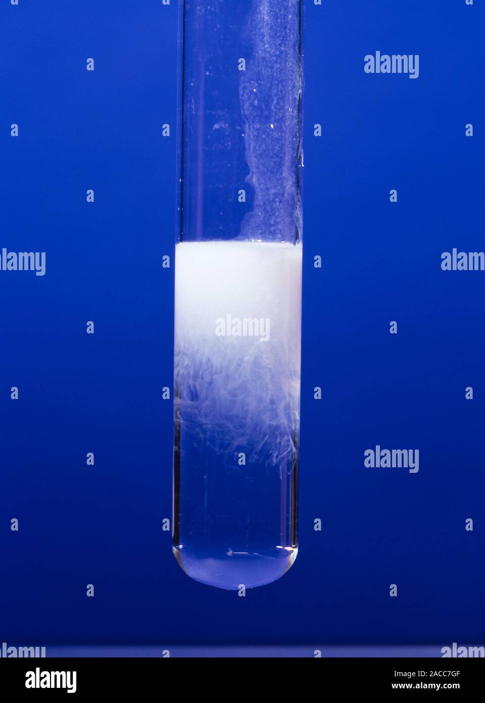 Calcium hydroxide precipitate formed by adding sodium hydroxide (NaOH ...