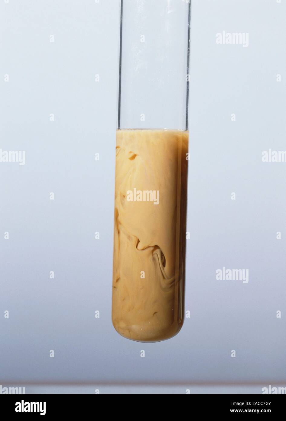 Silver hydroxide precipitate formed by adding sodium hydroxide (NaOH ...