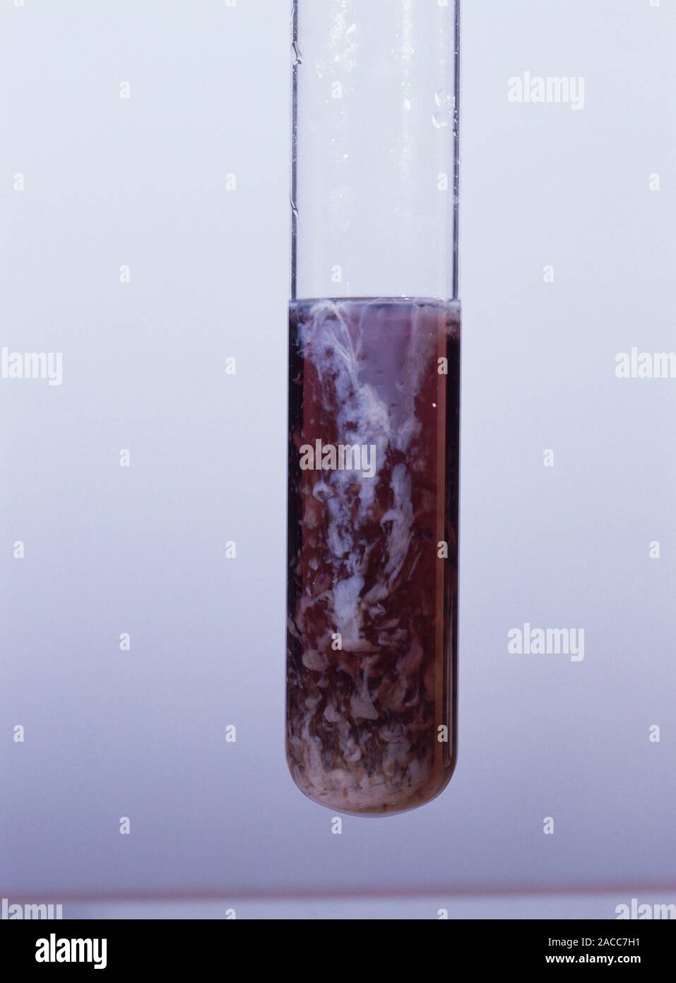 Chromium hydroxide precipitate formed by adding sodium hydroxide (NaOH ...