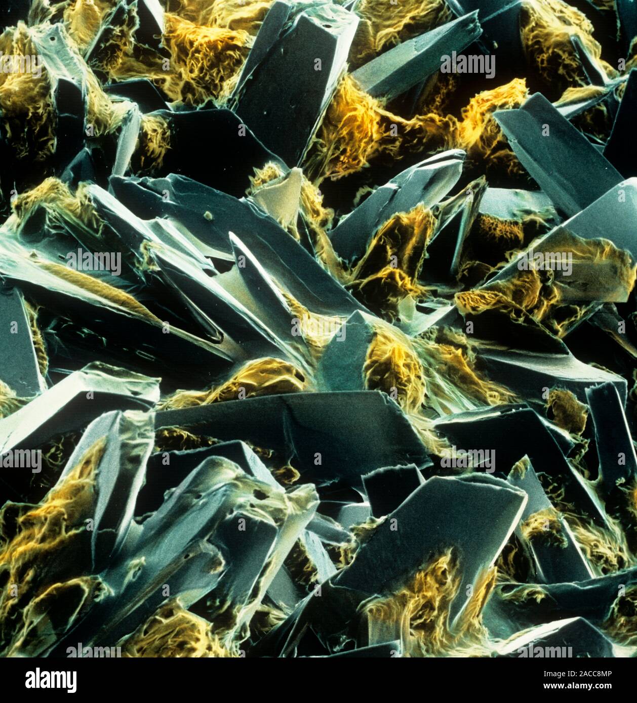 False-colour scanning electron micrograph of crystals of glucose, a ...