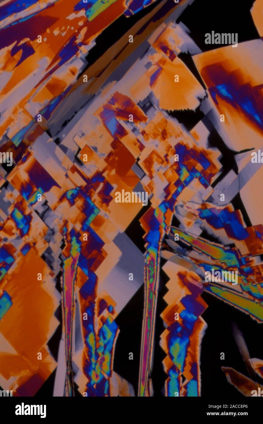 Cholesterol. Polarised light micrograph of crystals of cholesterol ...