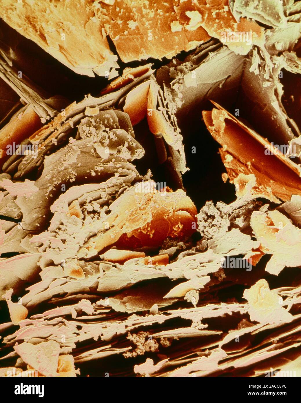 False-colour scanning electron micrograph of crystals of monohydrate ...