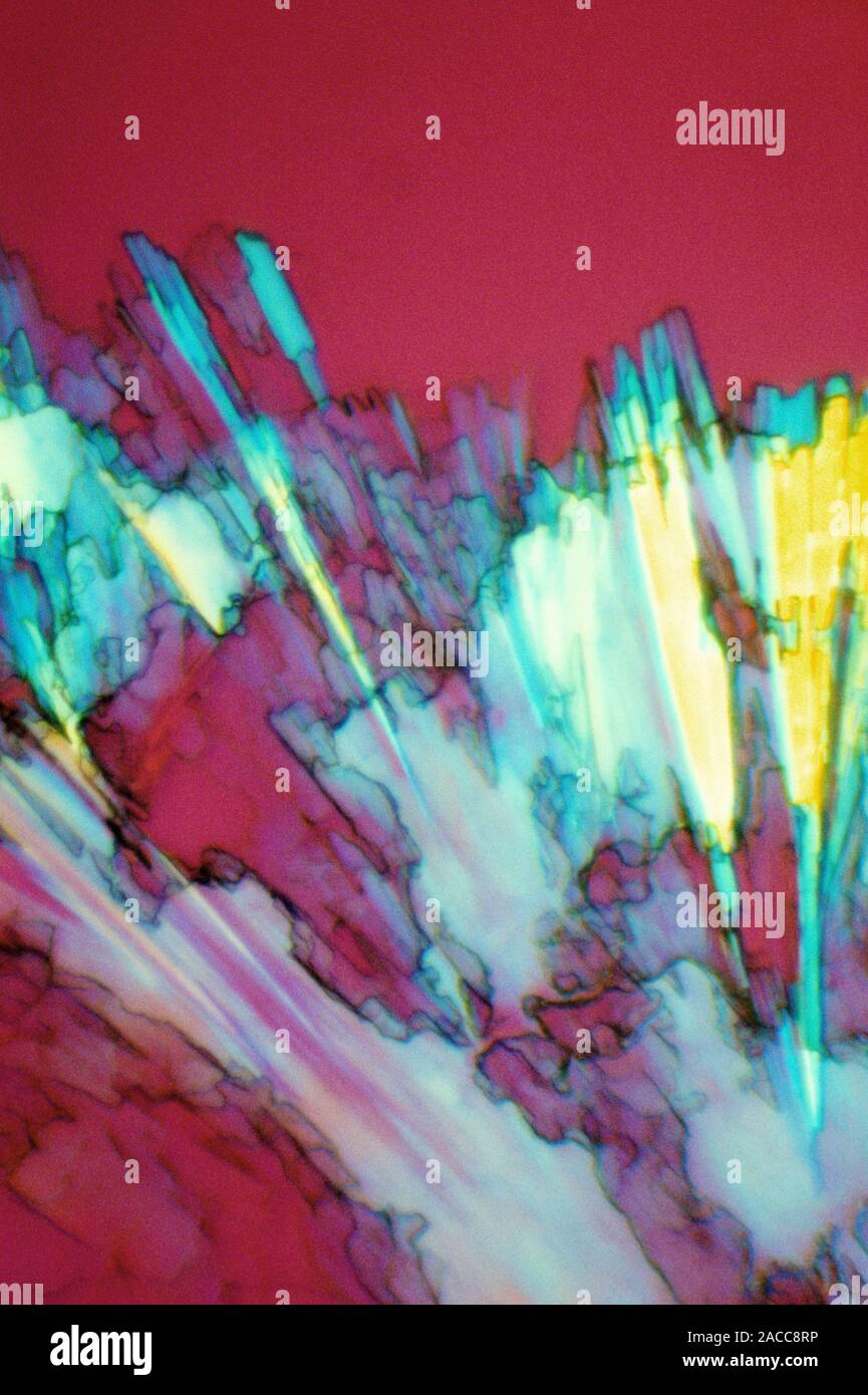 Cholesterol. Polarized light micrograph of crystals of cholesterol ...