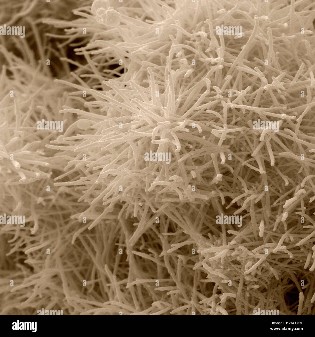 Witherite crystals. Coloured scanning electron micrograph (SEM) of ...