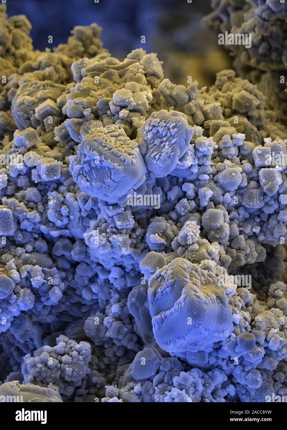 Limescale. Coloured scanning electron micrograph (SEM) of limescale ...