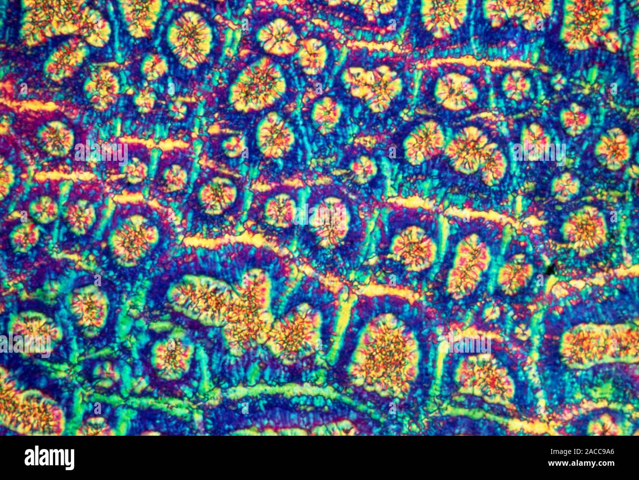Polarised light micrograph of liquid crystals. Magnification: x100 at ...