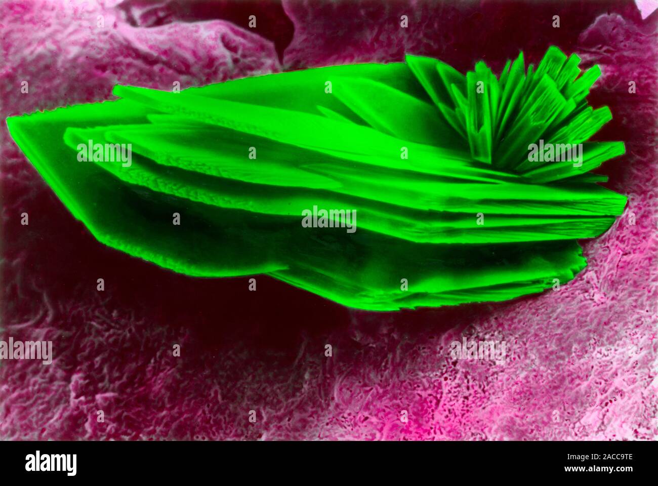 Albumin crystals. Coloured scanning electron micrograph (SEM) of ...