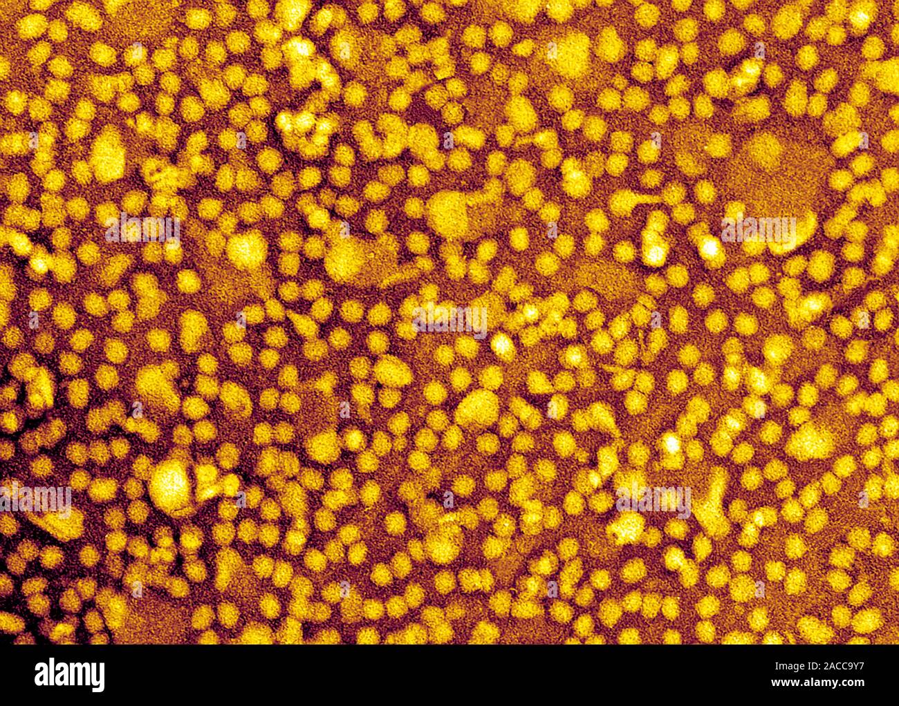 Low-density lipoproteins. Coloured transmission electron micrograph ...