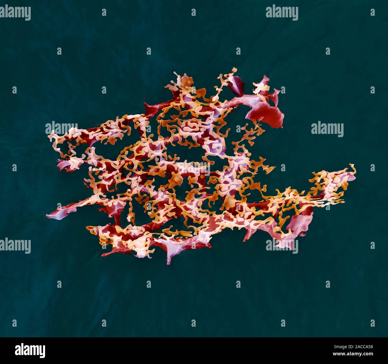 Escherichia coli endotoxin, coloured scanning electron micrograph (SEM ...