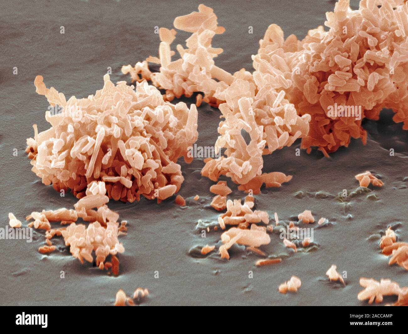 Salbutamol sulphate crystals, coloured scanning electron microscope ...