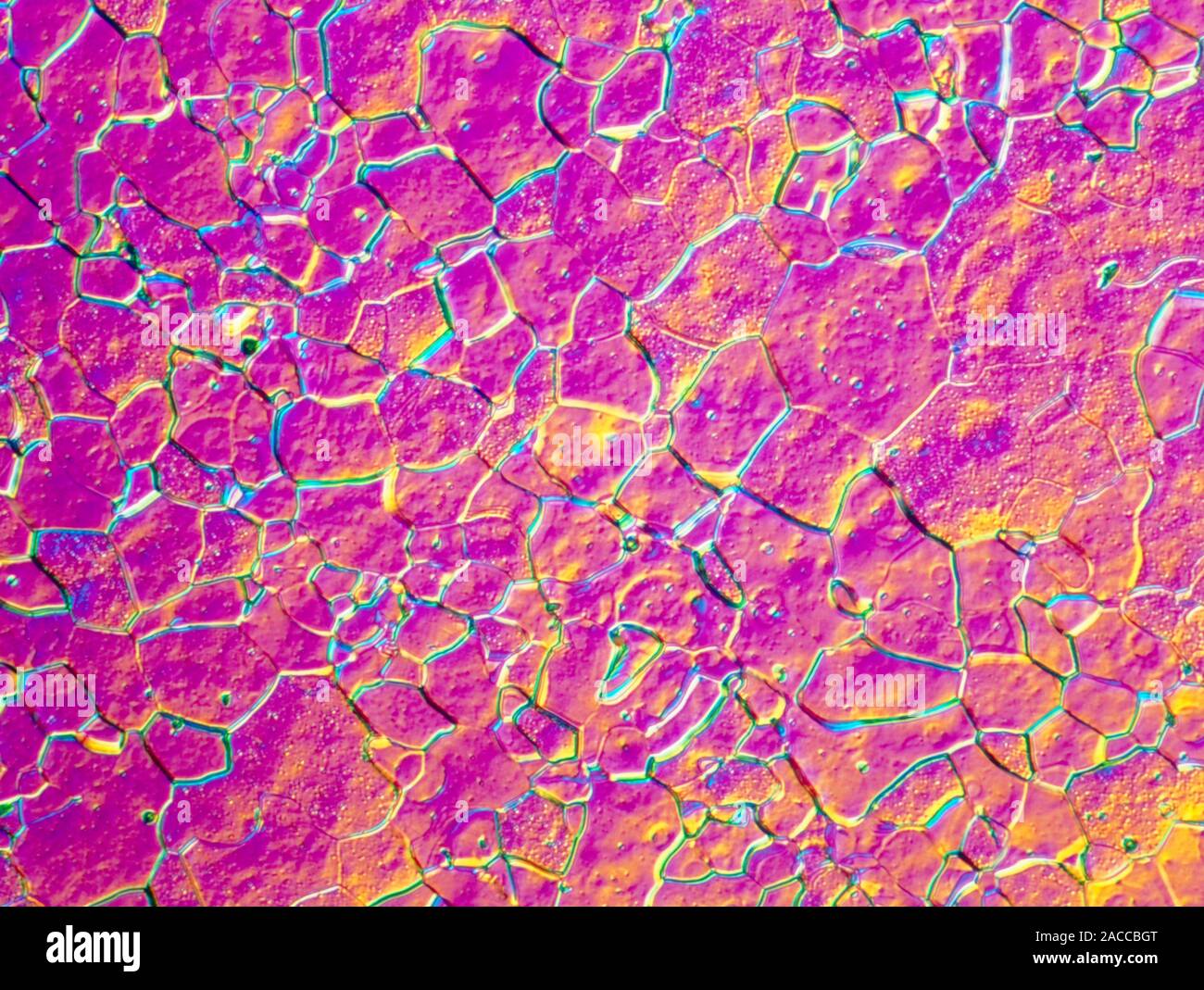 Light micrograph of a thin section of tantalum (symbol Ta). Tantalum is ...