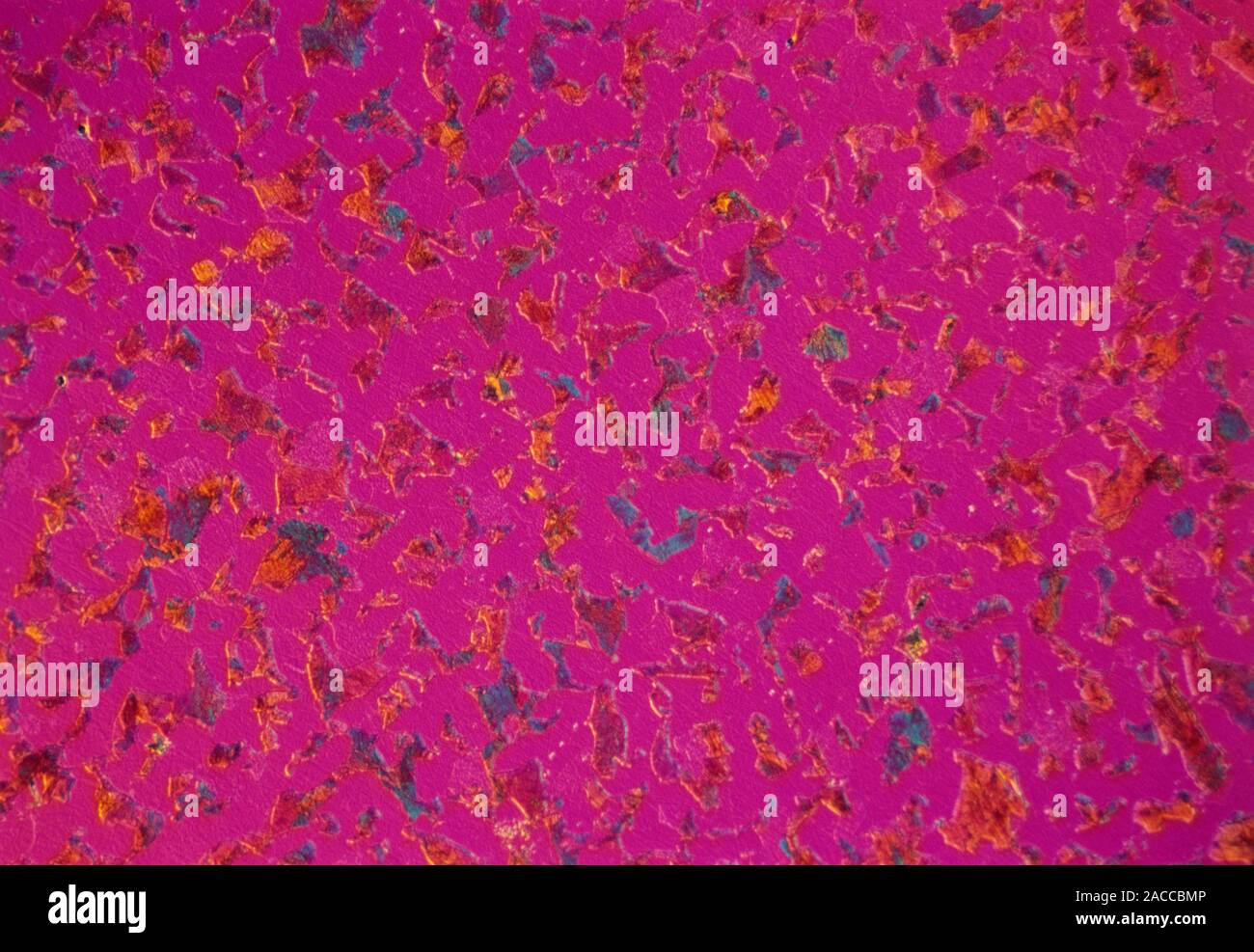 Medium carbon steel. Light micrograph of a thin section of normalised ...