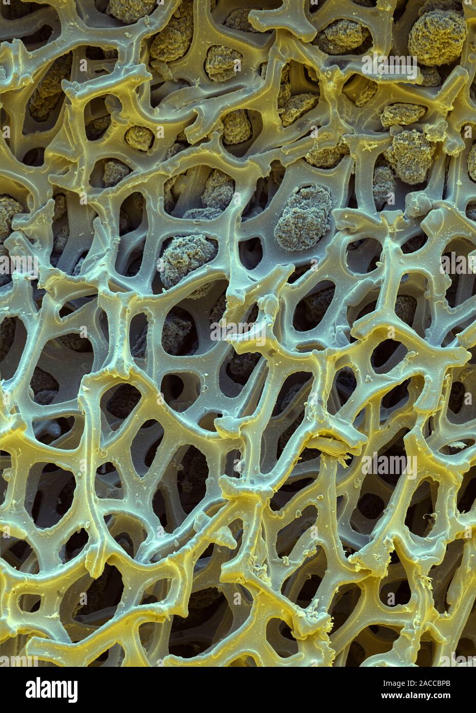 Nickel foam. Coloured scanning electron microscope (SEM) of foamed ...
