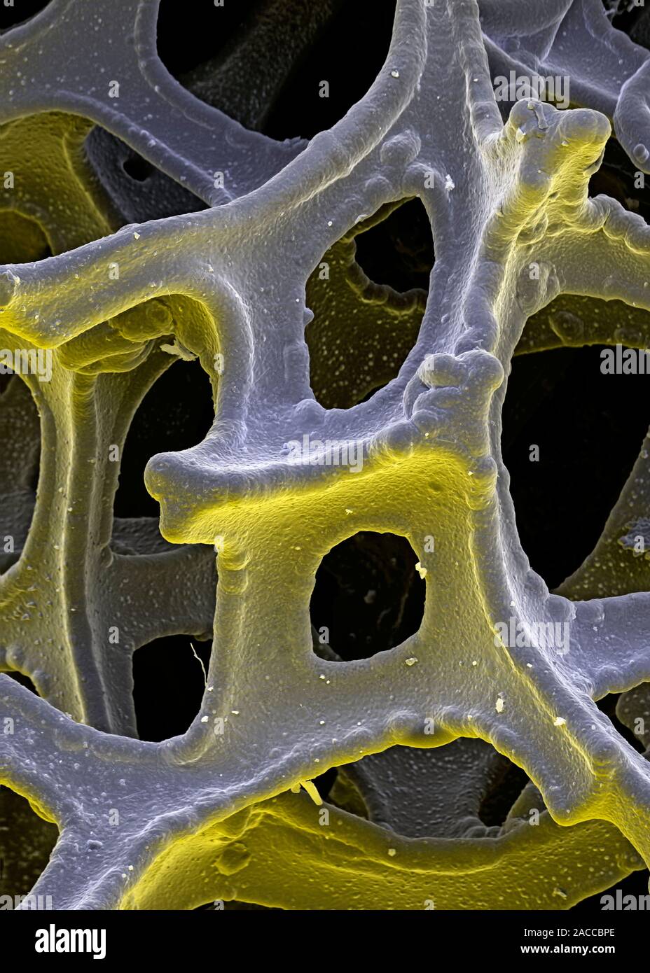 Nickel foam. Coloured scanning electron microscope (SEM) of foamed ...
