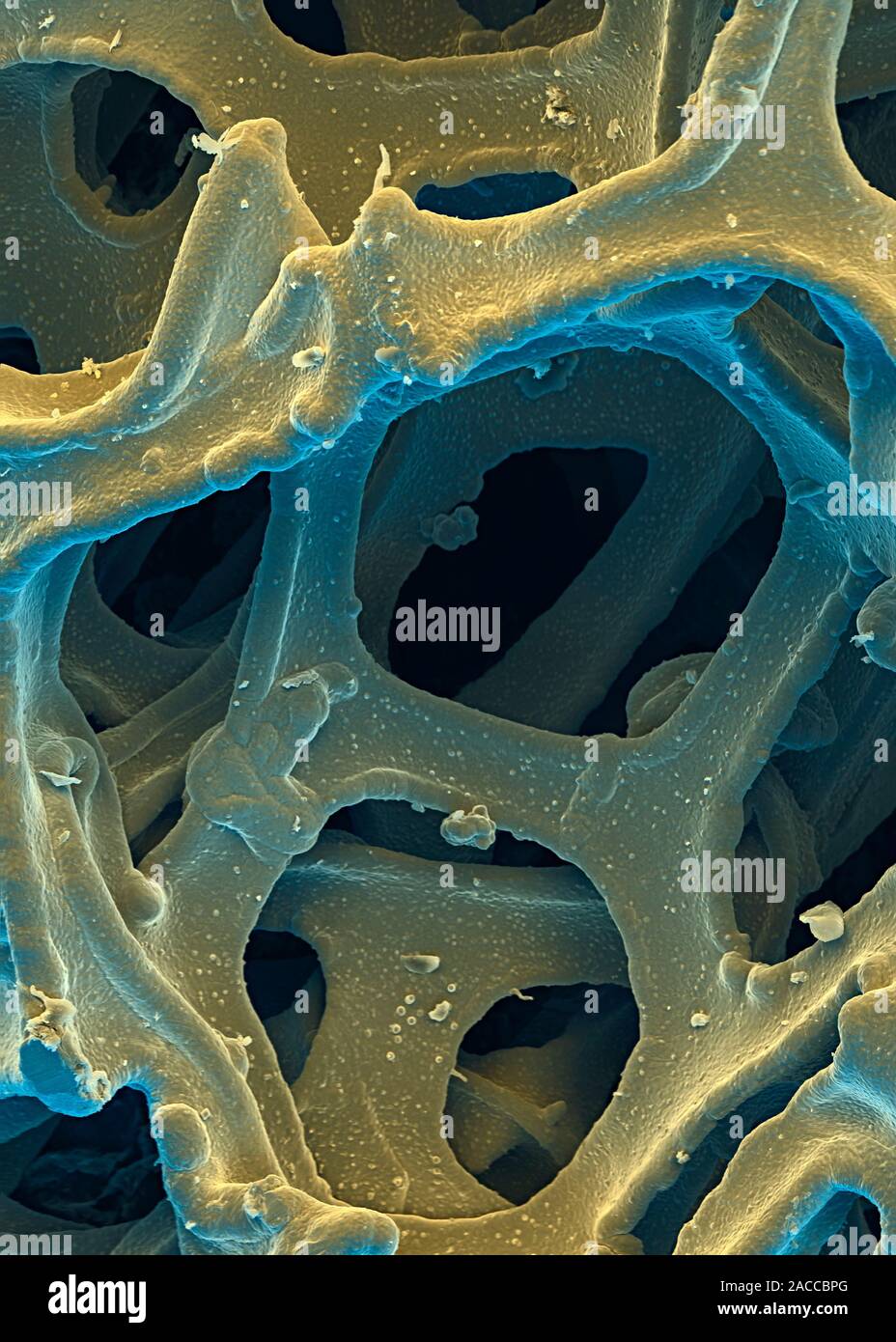 Nickel foam. Coloured scanning electron microscope (SEM) of foamed ...