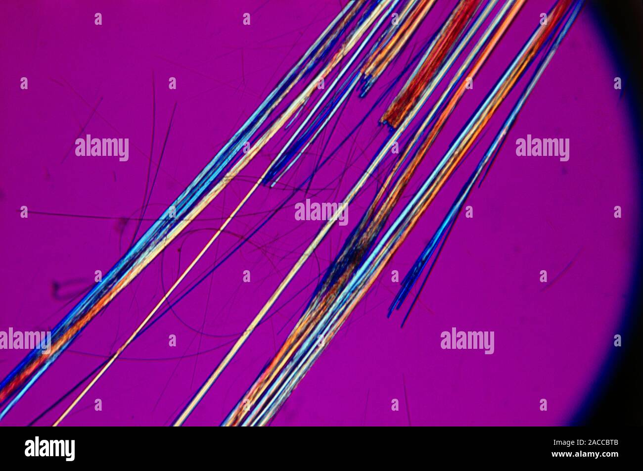 Polarised light micrograph of fibres of amosite, a type of asbestos ...