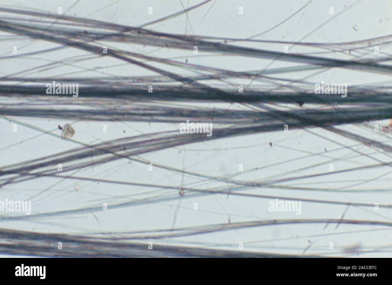 Light micrograph of fibres of blue asbestos, or crocidolite. All ...