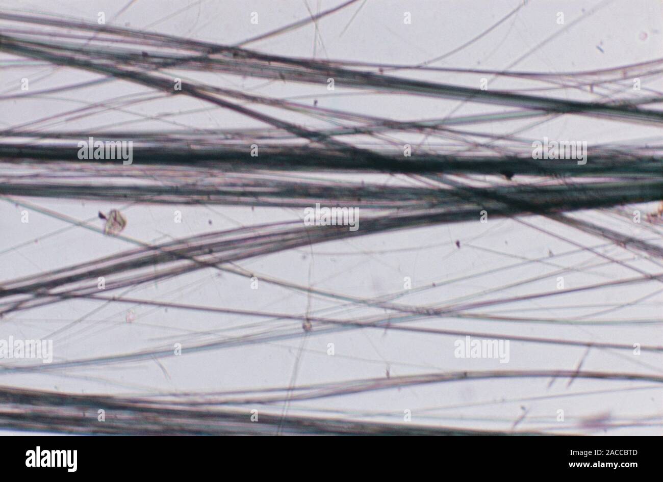 Light micrograph of fibres of blue asbestos, or crocidolite. All ...