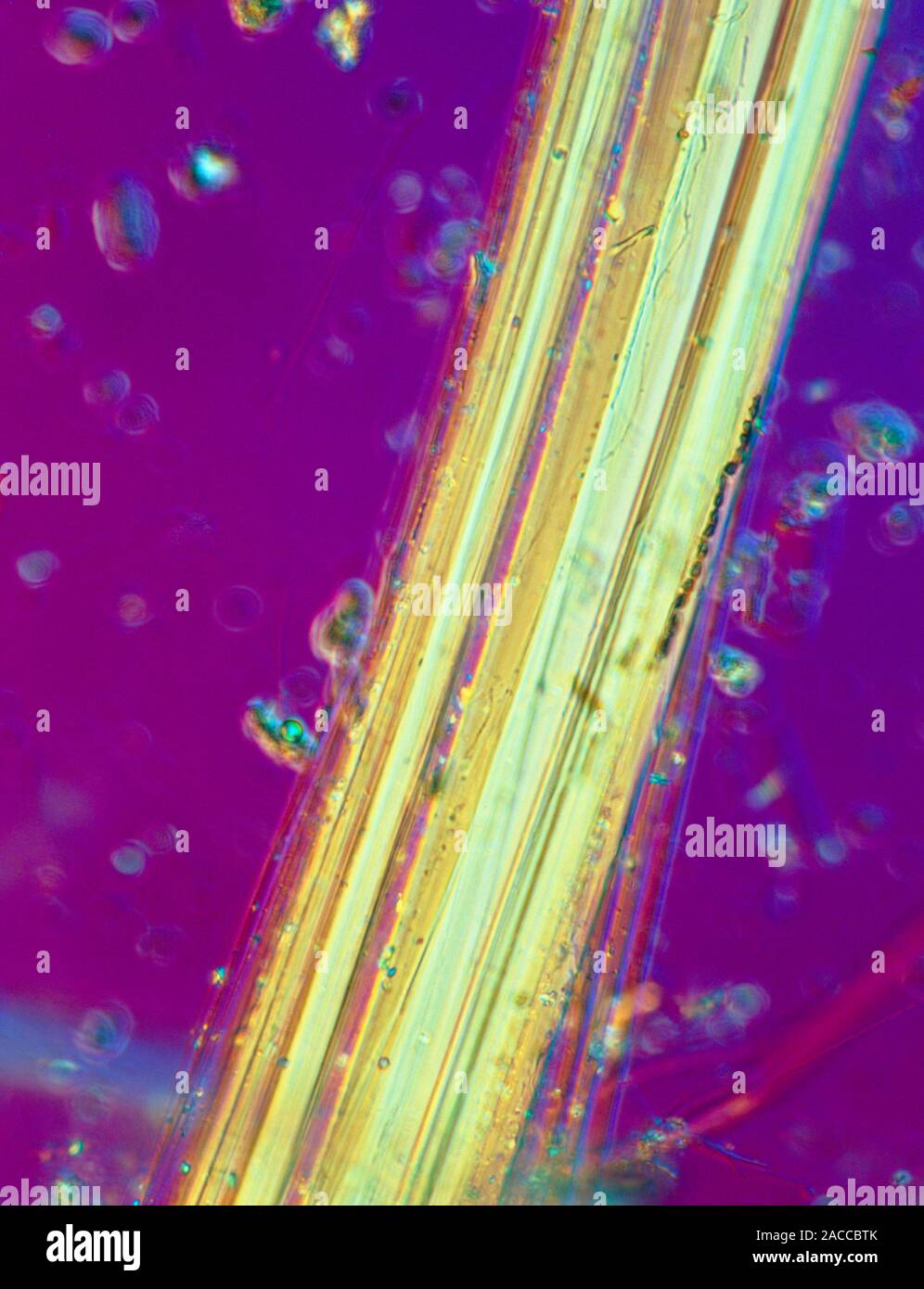 Light micrograph of some fibres of asbestos (an amphibole mineral). The ...