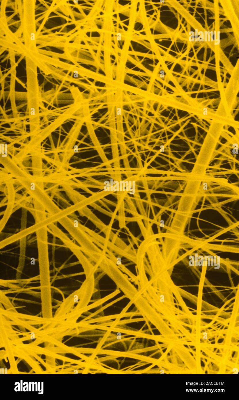 False-colour scanning electron micrograph of the fibrils which make up ...
