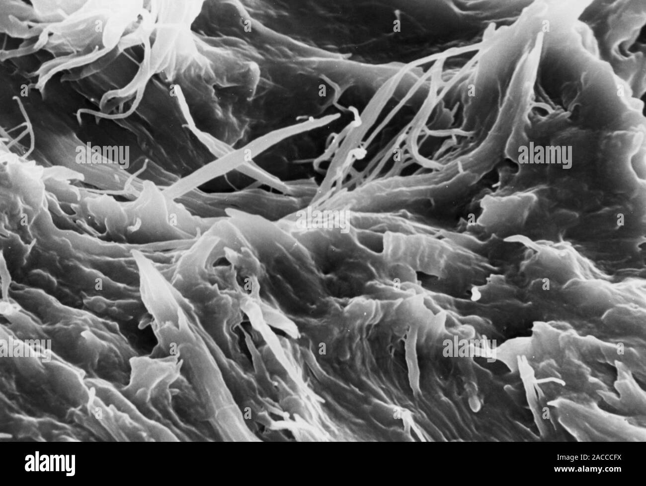Rocket fuel. Scanning Electron Micrograph (SEM) of crystals of solid ...