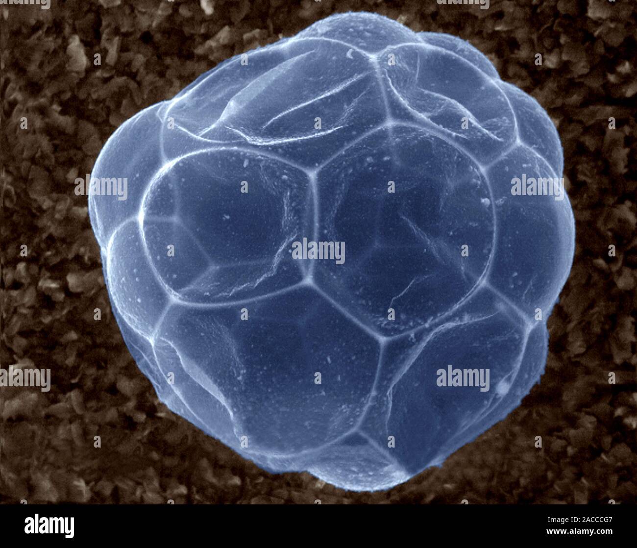 Diesel. Coloured environmental scanning electron micrograph (ESEM) of a ...