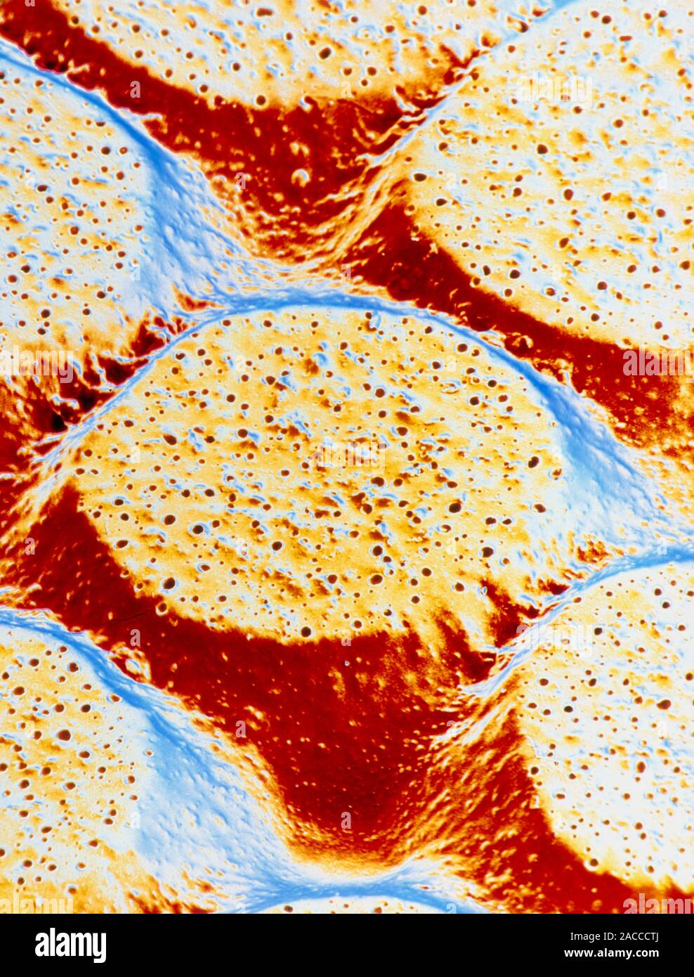 False-colour scanning electron micrograph of the surface of a ...