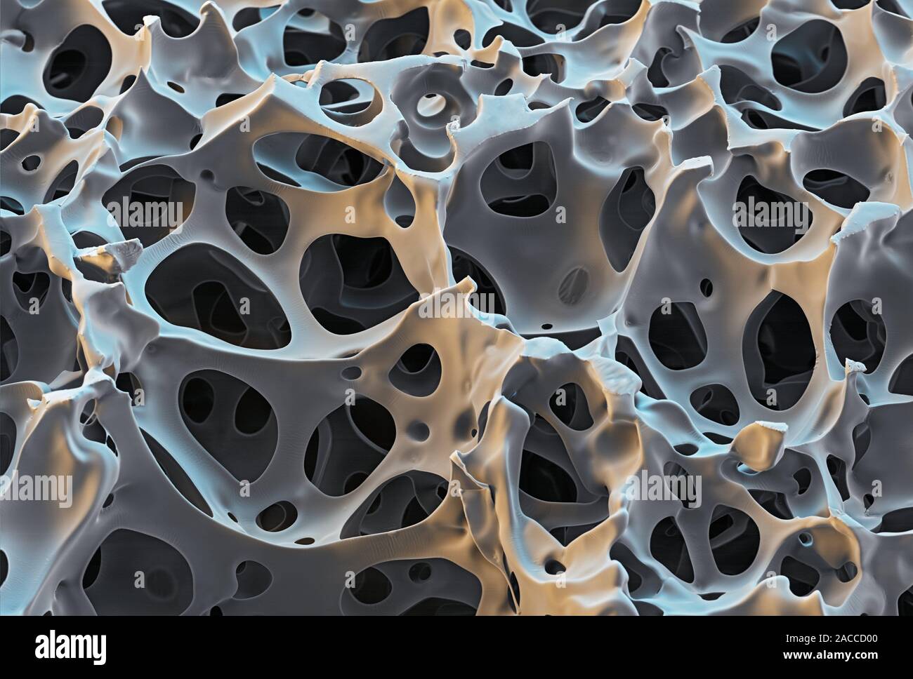 Superabsorbent polymer, coloured scanning electron micrograph (SEM ...