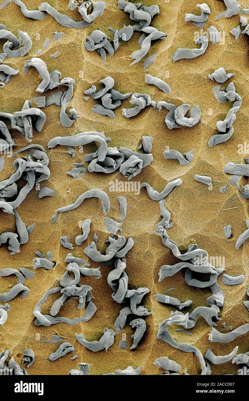 Teflon. Coloured scanning electron micrograph (SEM) of Teflon ...