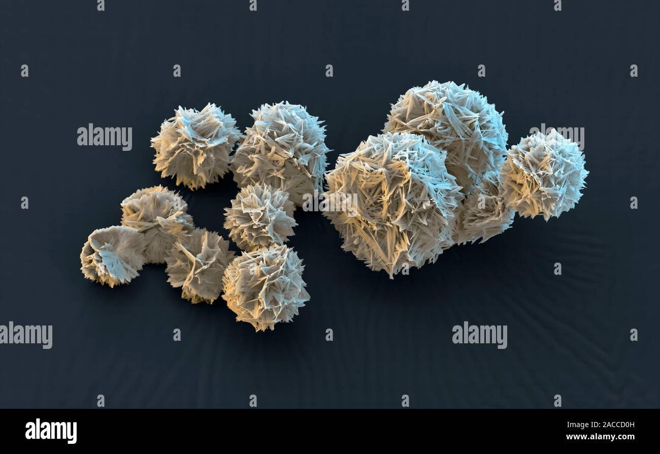 Polyvinylpyrrolidone (PVP), coloured scanning electron micrograph (SEM ...