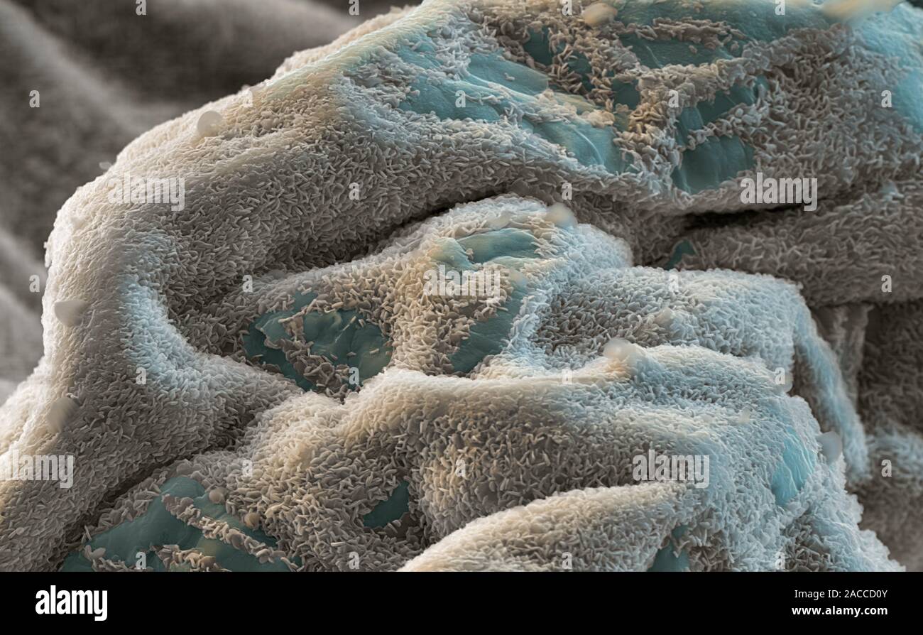 Polyacrylic acid, coloured scanning electron micrograph (SEM). This is ...
