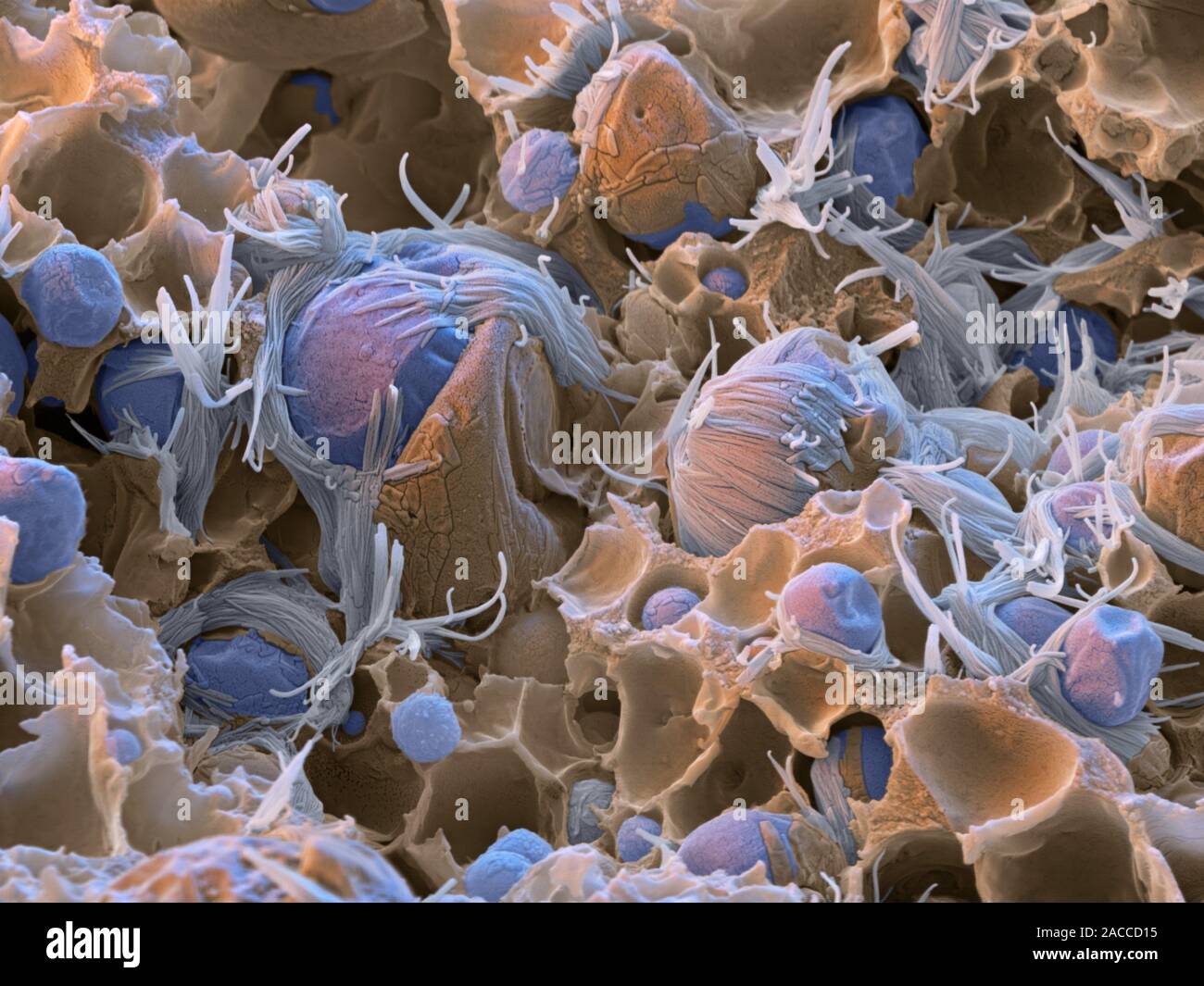 Polyacrylic acid, coloured scanning electron micrograph (SEM). This is ...