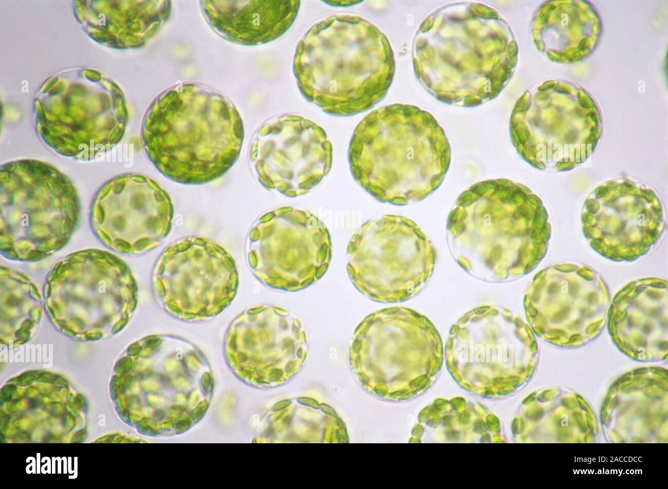 Light micrograph of protoplasts from a tobacco leaf, Nicotiana ...