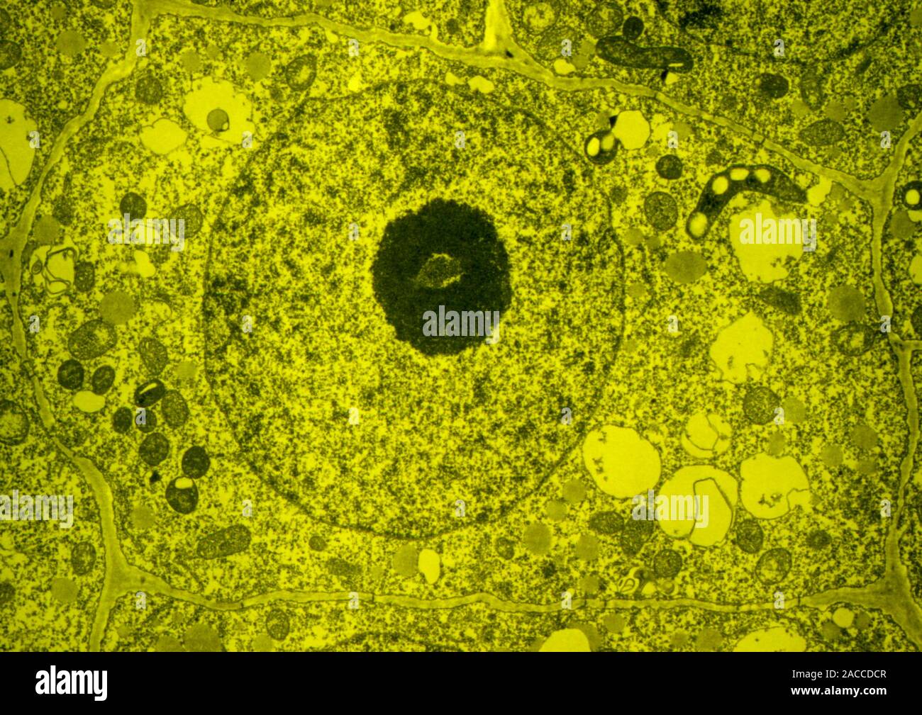 False colour transmission electron micrograph of a plant cell from the ...