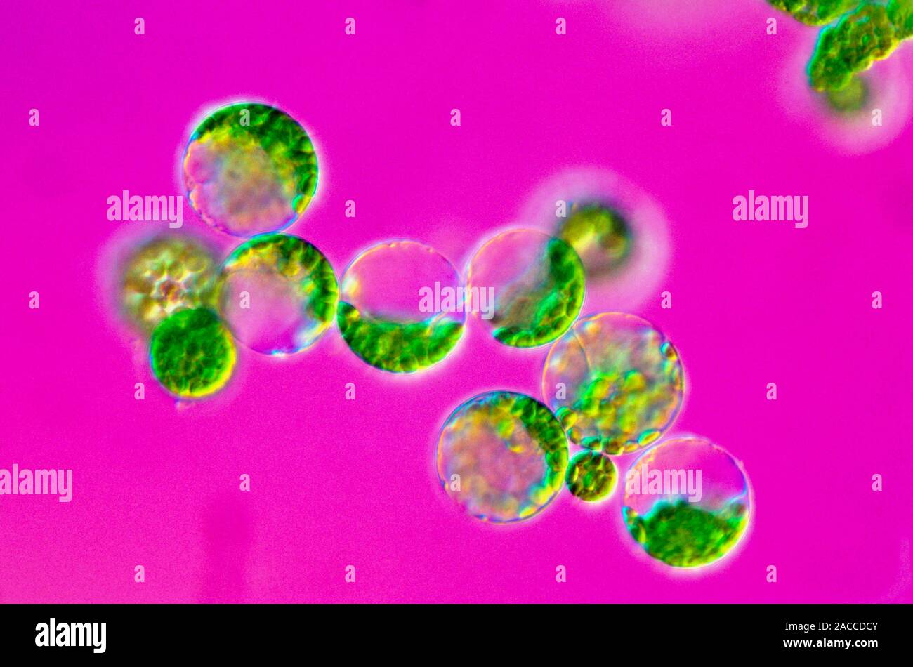 Light micrograph of a group of protoplasts from a leaf. A protoplast is ...