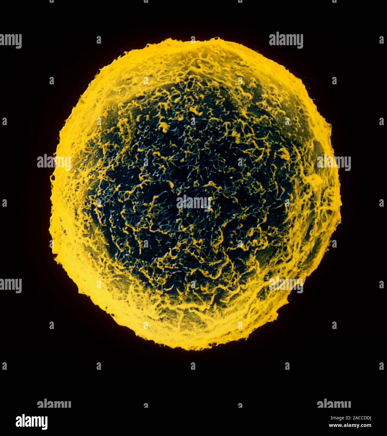 False-colour scanning electron micrograph of a protoplast of the moss ...