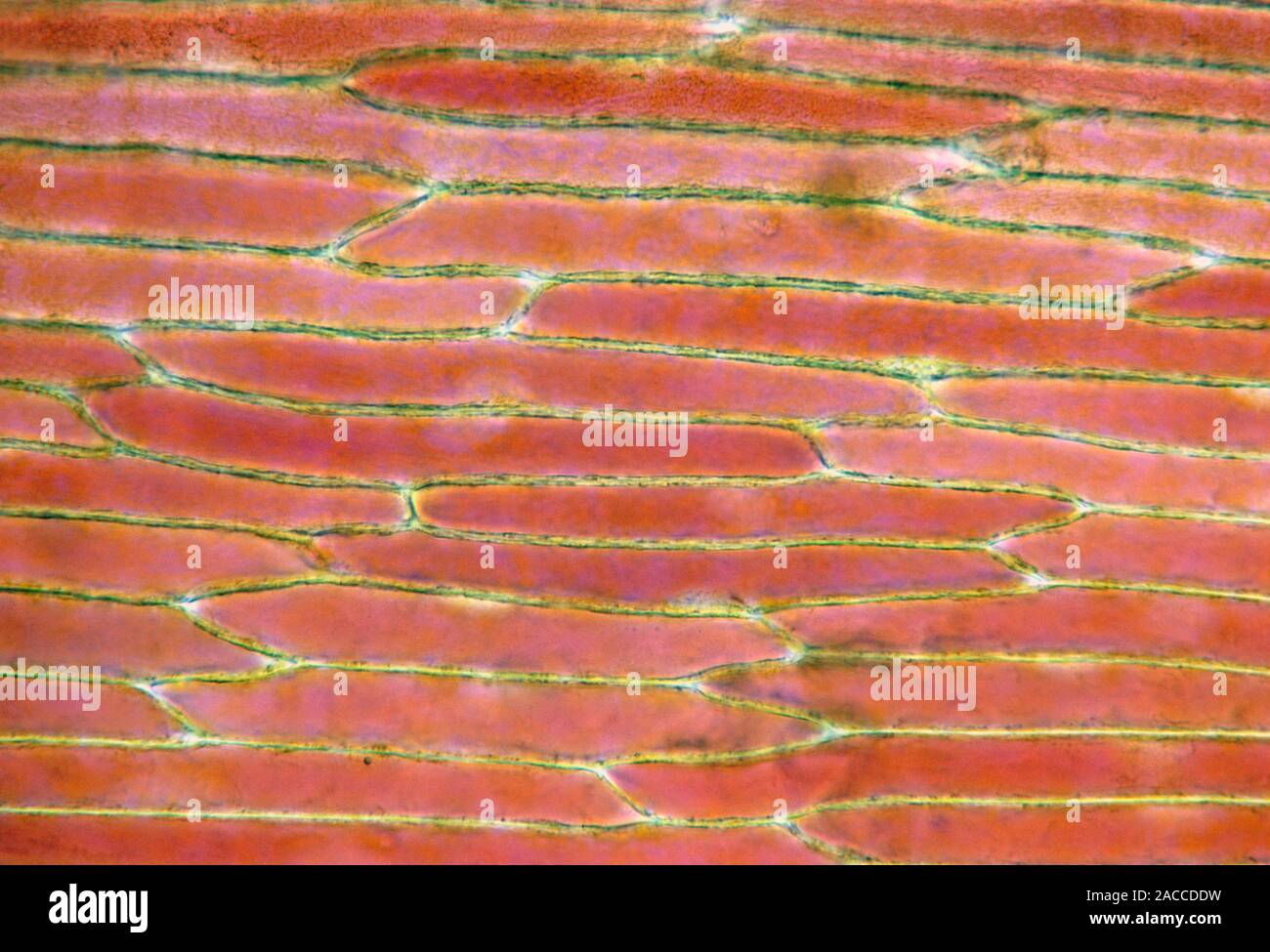 Light micrograph of a tulip petal. This photograph shows the cells of a ...