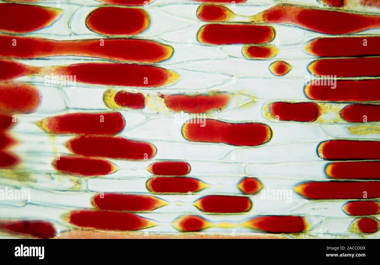 Light micrograph of a wilted tulip petal. In the cells of a fresh petal ...