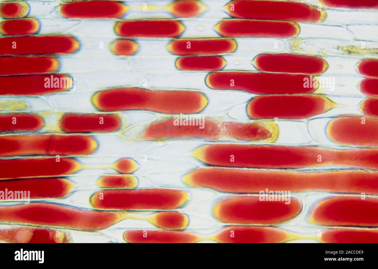 Light micrograph of a wilted tulip petal. In the cells of a fresh petal ...